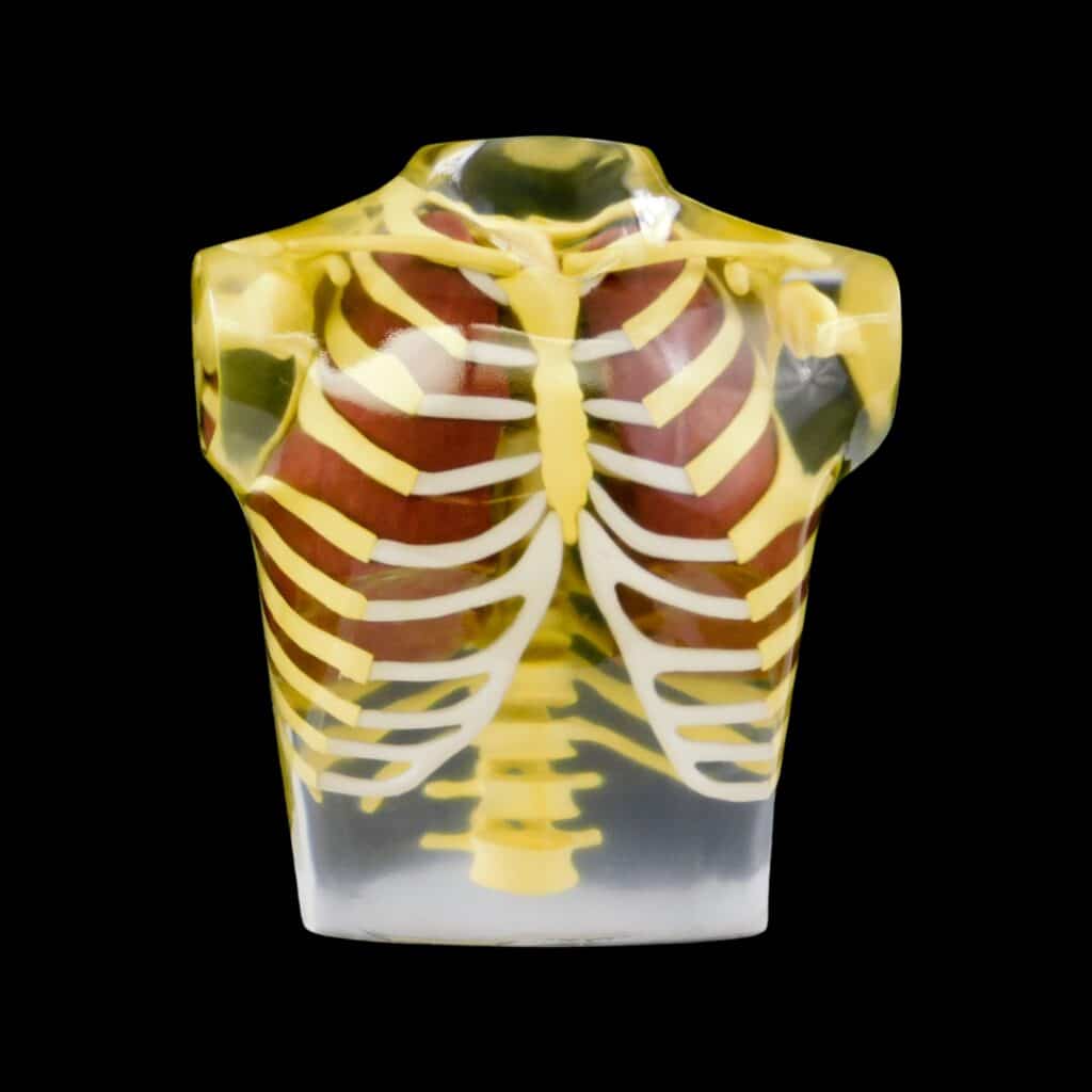 Thorax Phantom - Radiology Support Devices Inc.